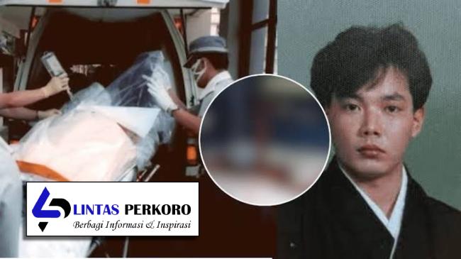 Kisah Tragis Hisashi Ouchi Pria Dengan Kulit Meleleh Menjelang Kematiannya